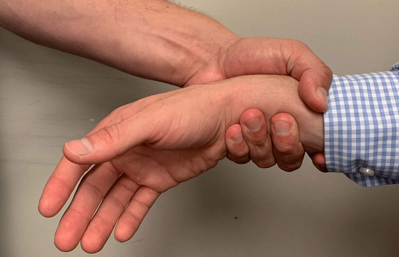 De Quervain’s tenosynovitis - Chiropraxie Lochristi